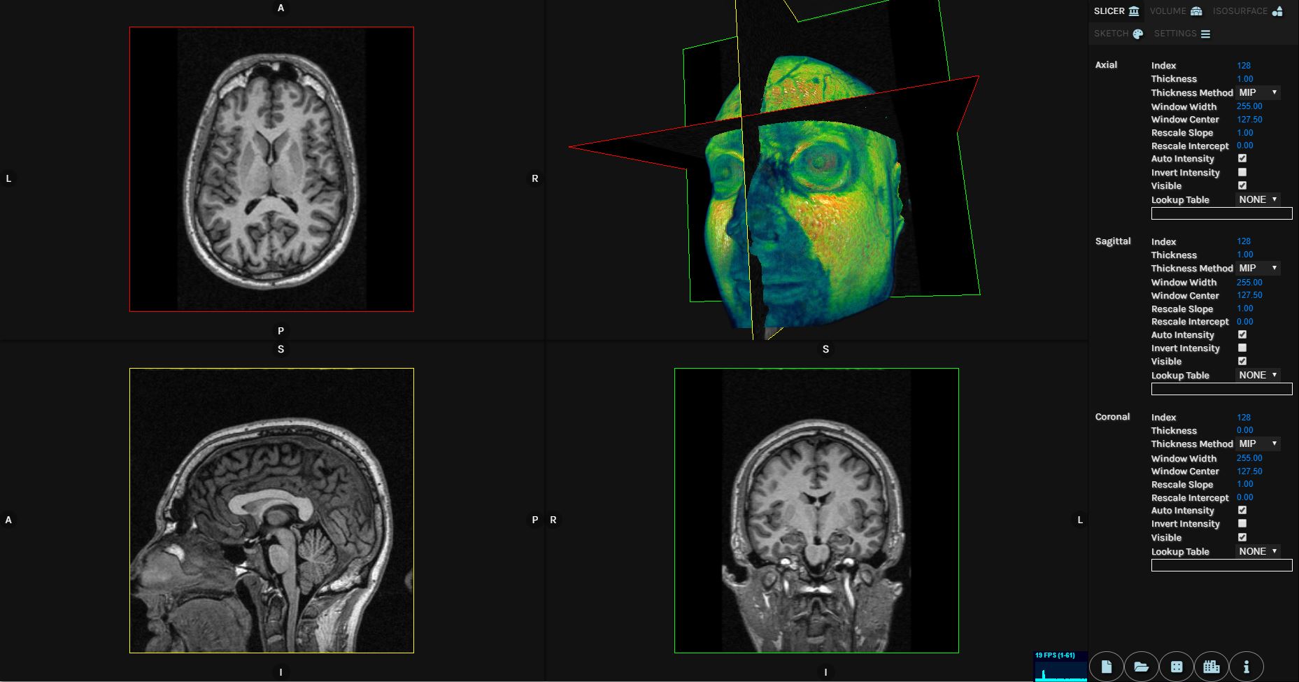 GitHub - sangkunine/MedicalWorks: A WebGL-based 3D Medical Solution